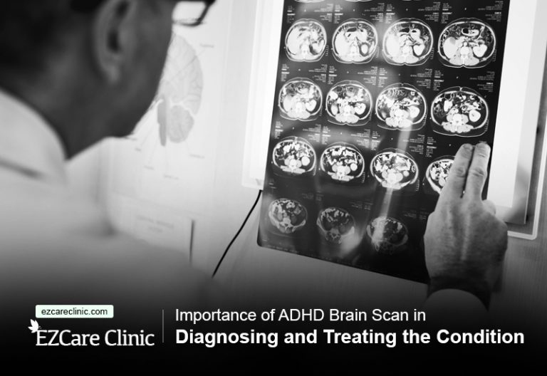 Importance of ADHD Brain Scan in Diagnosing and Treating the Condition