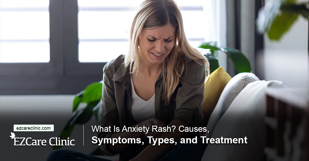 What Is Anxiety Rash? Causes, Symptoms, Types, and Treatment